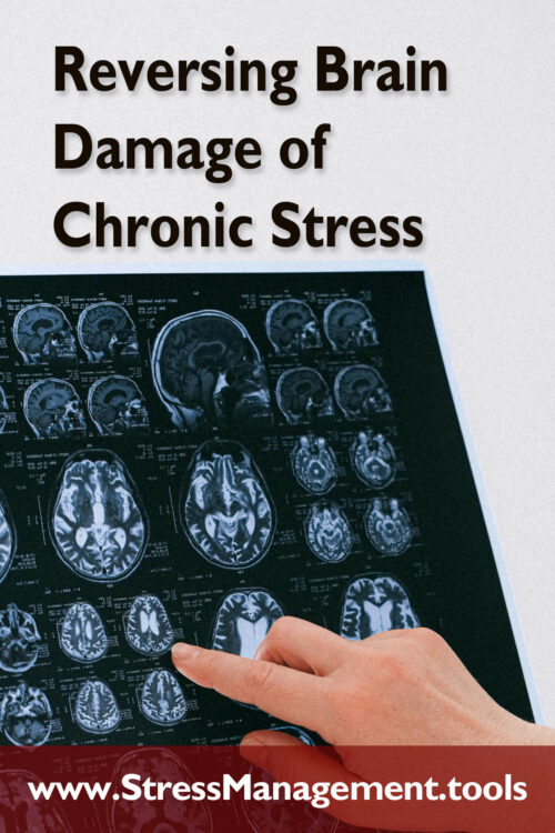 Reversing Brain Damage of Chronic Stress – Abundant Health